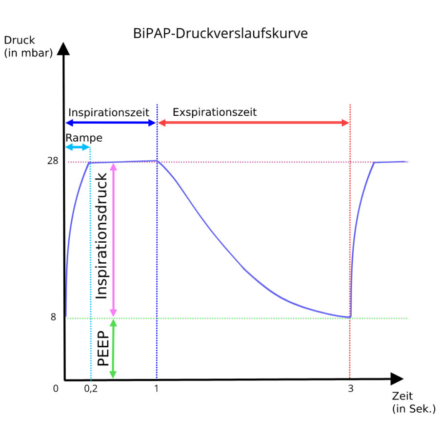 BiPAP-Beatmung - das sollten Sie wissen!